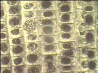 Preparación microscópica de allinium (tipo de cebolla) | Zeigen